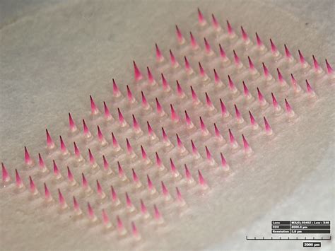Microneedle Patches For Flu Immunisation Phase I Trial Pumping Marvellous
