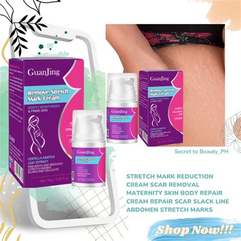 Stretch Mark Reduction Cream Scar Removal Maternity Skin Body Repair