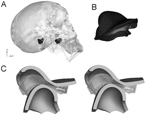Figure A Three Dimensional Finite Element Model Of The Download Scientific Diagram