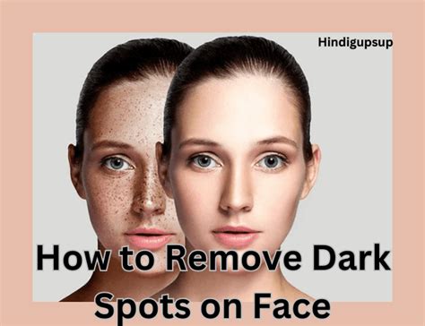 चेहरे के काले दाग धब्बे को हटाने के घरेलू उपाय क्या है How To Remove