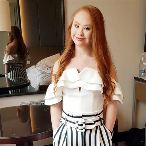 Down Syndrome Model Madeline Stuart Struggles To Find Work In Australia Hot Sex Picture