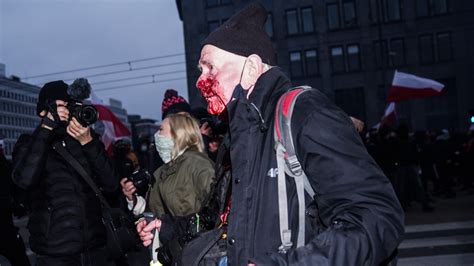 Marsz Niepodległości Fotoreporter Tomasz Gutry o postrzeleniu przez