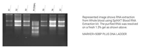 Blood RNA Extraction Isolation Purification Kit Solutions Microarray Analysis Reverse