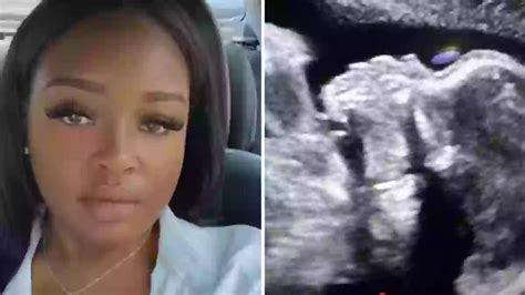 Pregnant Woman Who Has Been Declared Brain Dead Forced To Be Kept Alive