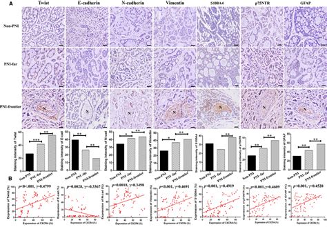 Cxcr4 Expression Closely Connected With The Level Of Emt‐related