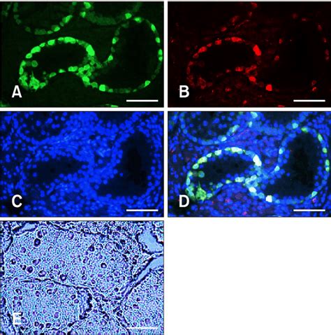 Characterization Of Spermatogonial Stem Cells Sscs In 1 Month Old