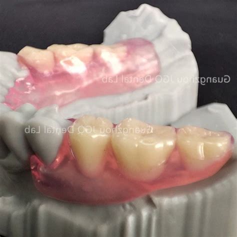 Popular Natural Looking Flexible Valplast Dentures Durable Dental