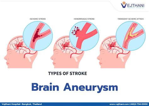 Types Of Hemorrhagic Stroke