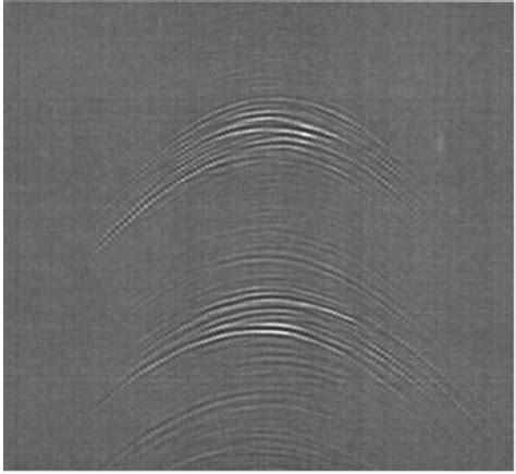 Figure 5 From The Detection Of Breast Microcalcifications With Medical