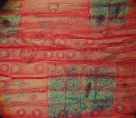Tracheids In Roots