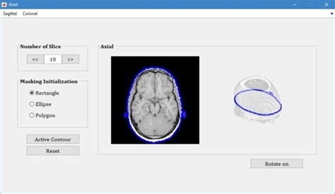 Segmentasi Citra Mri Dengan Metode Active Contour Pemrograman Matlab