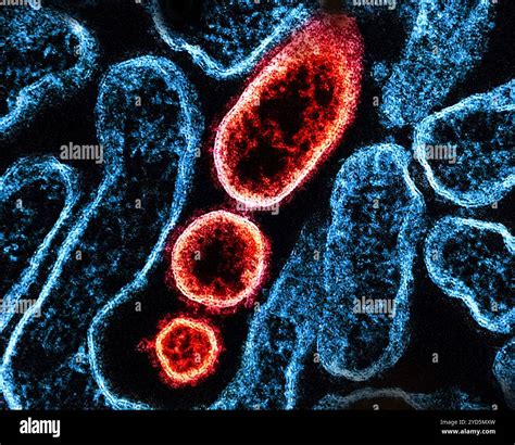 Colorized Transmission Electron Micrograph Of Mature Extracellular Nipah Virus Particles Red