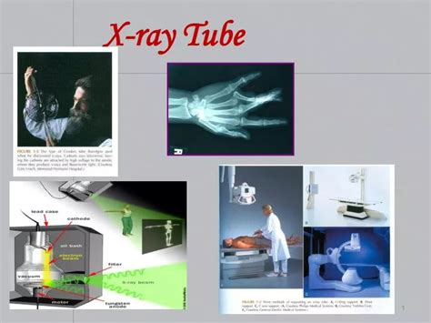 X Ray Ppt