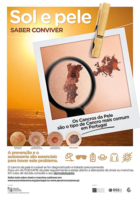 Campanha De Prevenção Do Cancro Da Pele Câmara Municipal De Santiago