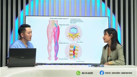 НУРУУНЫ ӨВДӨЛТ СУУДАЛ МЭДРЭЛИЙН ДАРАГДАЛ Пэпэ эмчийн зөвлөгөө №04