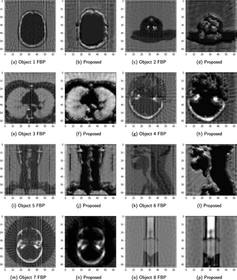 Reconstructed Images From 35 Projection Views Using Transform Based Download High