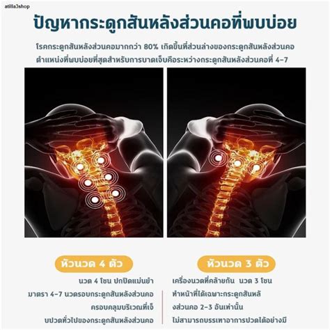 Pp เครื่องงนวด จัดส่งทันท ต้นคอ คอ คอไฟฟ้า นวดบ่าและไหล่ นวดไหล่ นวดชีพ