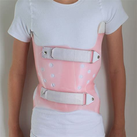 Different Types Of Back Braces For Scoliosis At Jonathan Baylee Blog