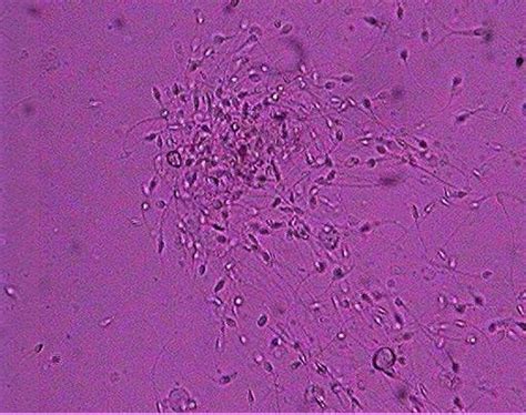 A Normal Human Sperm Sample Observed At X400 Magnification B Download Scientific Diagram