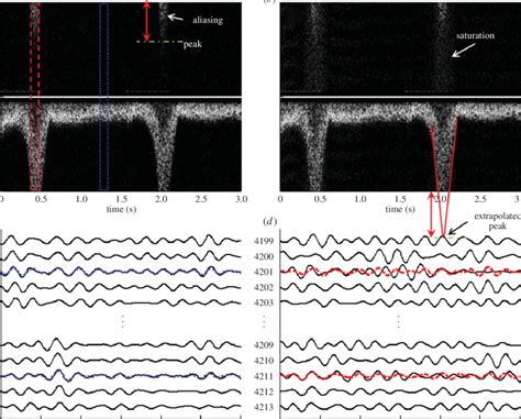 Doppler Flow Waveforms With Aliasing Artefacts Doppler Waveform Download Scientific Diagram