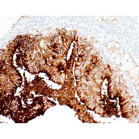 Anti-CA19-9 Antibody [IHC065] (A324510) | Antibodies.com