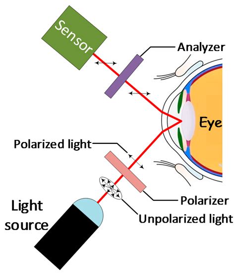 Paquete O Empaquetar Ubicación Mar Mediterráneo Bioreactor Glucose Monitoring Hecho Para