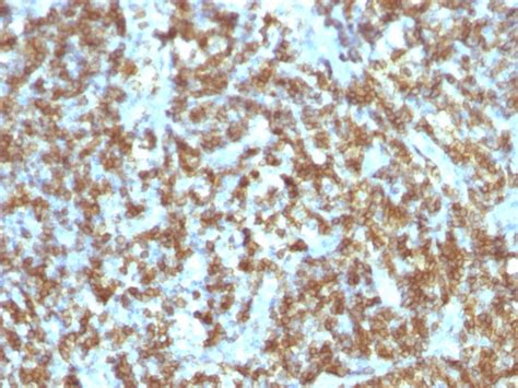 Cd45ro T Cell Marker Monoclonal Antibody Spm125 5788 Msm1x P1abx