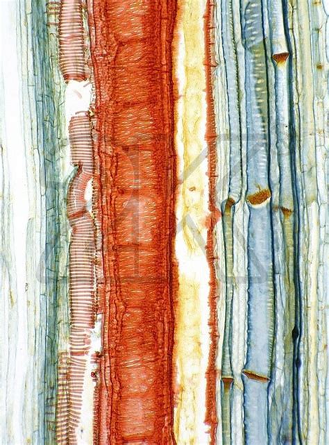 This Is Another Tree Cell Lots Of Different Colours Again And A