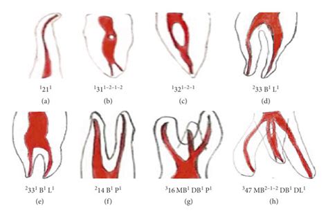 Classification Of Root And Root Canal Morphology In Permanent Dentition