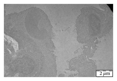 Electron Micrographs Of Ultrathin Lung Sections Of Negative Control