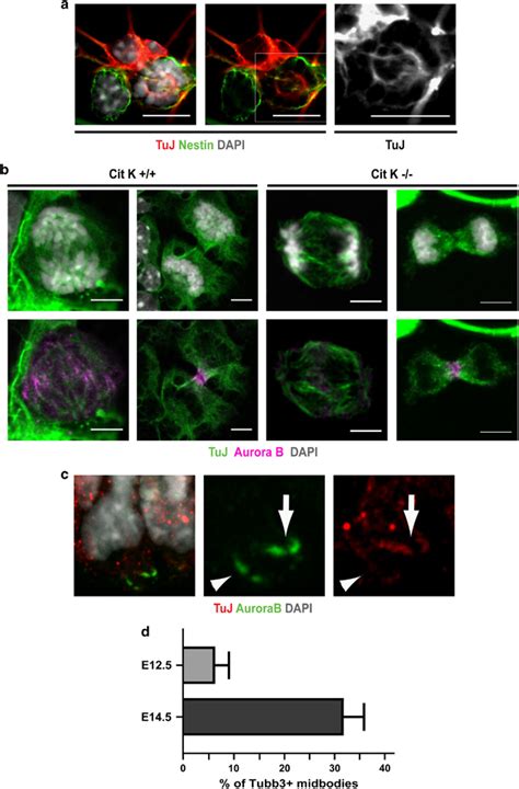 Expression Of Tubb3 In Proliferating Neuronal Progenitors A Cultures