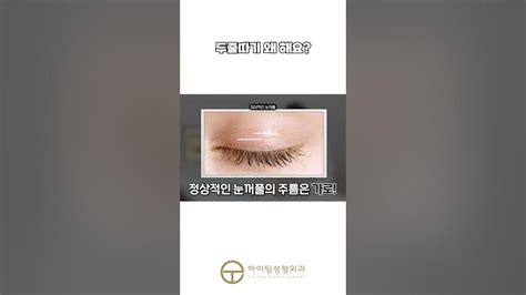 두줄따기 왜 해요 Shorts Youtube