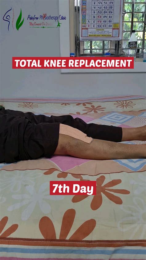Power Of Physiotherapy Rehabilitation Total Knee Replacement