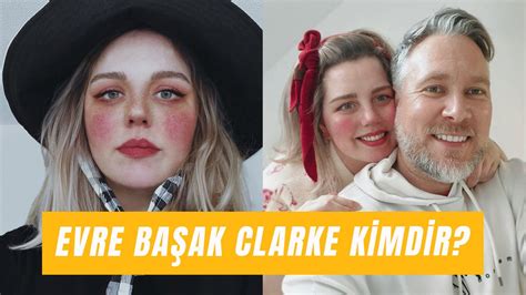 Evre Başak Clarke Kimdir Ünlü Sanatçı Ne Kanseri Antalya Gündem