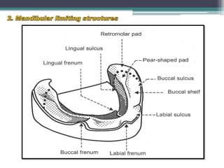 Anatomy Complete Denture Pdf