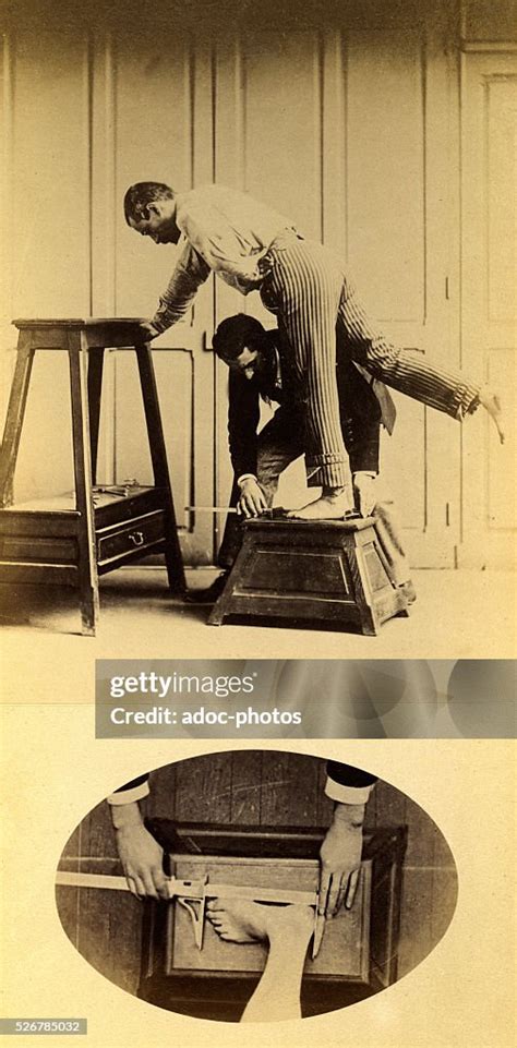 Anthropometric System Of Alphonse Bertillon Measurement Of The Foot