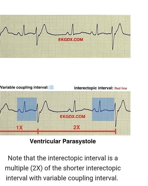 The Heart The Heart Added A New Photo