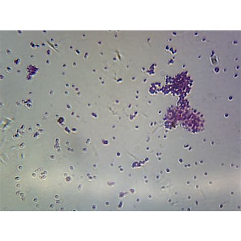 Diplococci