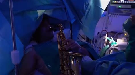Man Plays Saxophone While Doctors Perform Awake Brain Surgery On Him