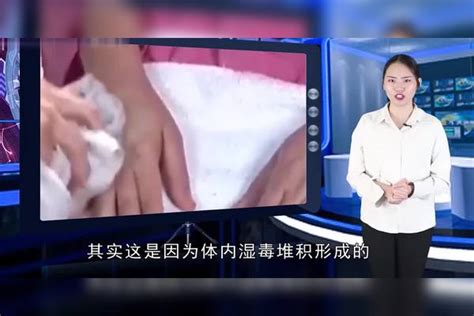 手上出现这东西就要小心，身体毒素特别多，赶紧去医院检查毒素身体东西