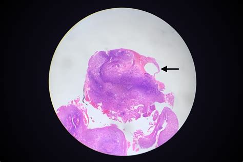 25 Facts About Vaginitis