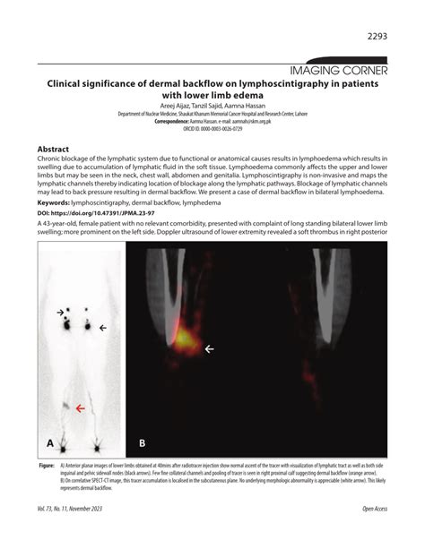 Pdf Clinical Significance Of Dermal Backflow On Lymphoscintigraphy In