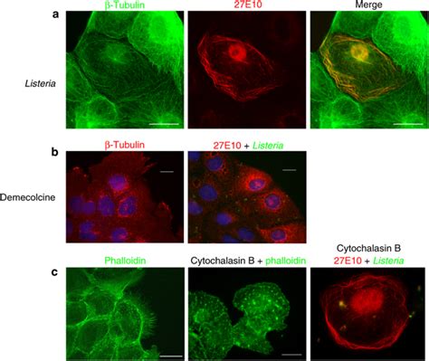 Colocalization Of Calprotectin And Microtubules A Laser Confocal