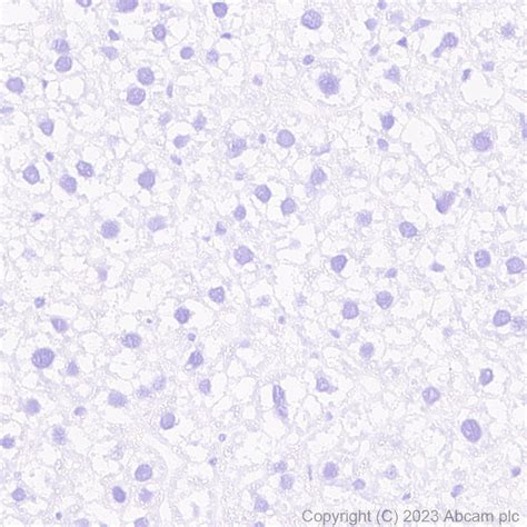 Somatostatin 28重组抗体 Rm1087 Somatostatin 28抗体ab315106