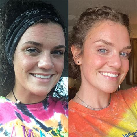 Top 20 Pictures Of People Before And After Quitting Alcohol Uk Best