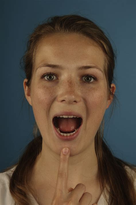 Postoperative Physiotherapy After Open Temporomandibular Joint Surgery