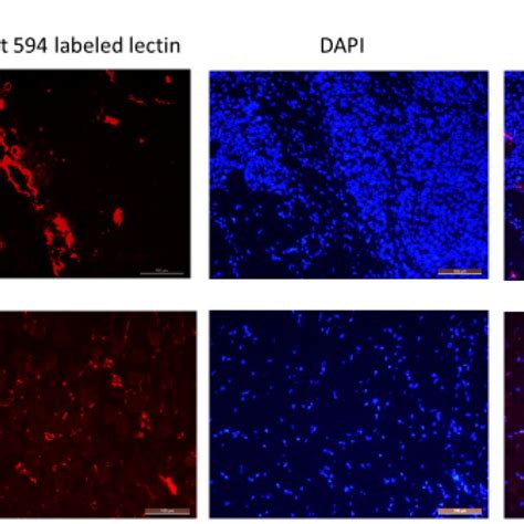 Down Regulation Of Rest Reduced Tumor Vascular Perfusion A The Mice