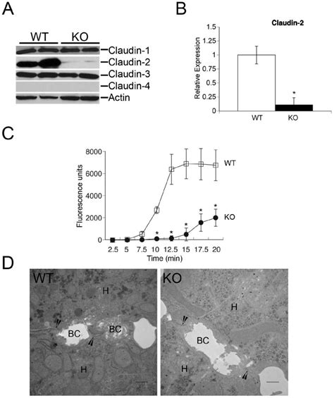 Liver Specific β Catenin Knockout Mice Have Bile Canalicular