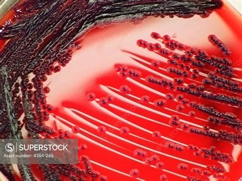 Chromobacterium Violaceum Bacterial Culture Superstock