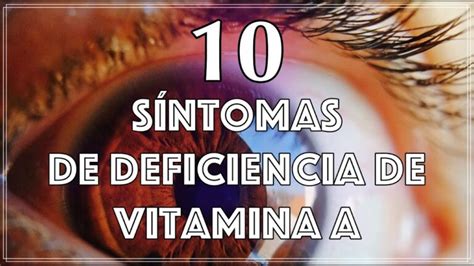 Importancia Del Cuidado Preventivo De La Vista En Niños Actualizado